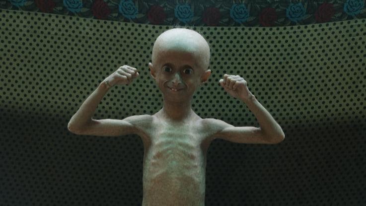 Beautiful Genetic Mutations In Humans