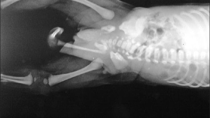 Learn About These Unique Genetic Mutations in Humans